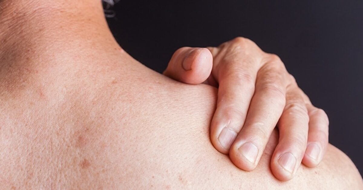 Shingles antiviral therapy | Accès pharma